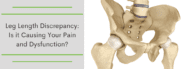 Leg Length Discrepancy: Is it Causing Your Pain and Dysfunction? | NETA