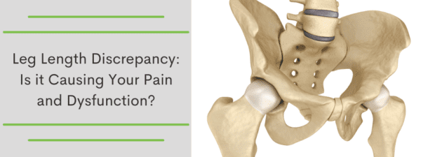 Leg Length Discrepancy: Is it Causing Your Pain and Dysfunction? | NETA