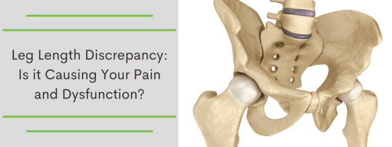 Leg Length Discrepancy: Is it Causing Your Pain and Dysfunction? | NETA