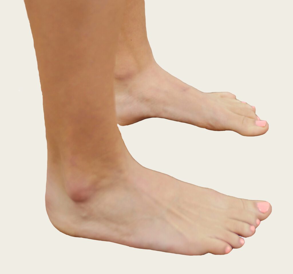 Assessing and Correcting Foot and Ankle Pain | NETA, National Exercise ...